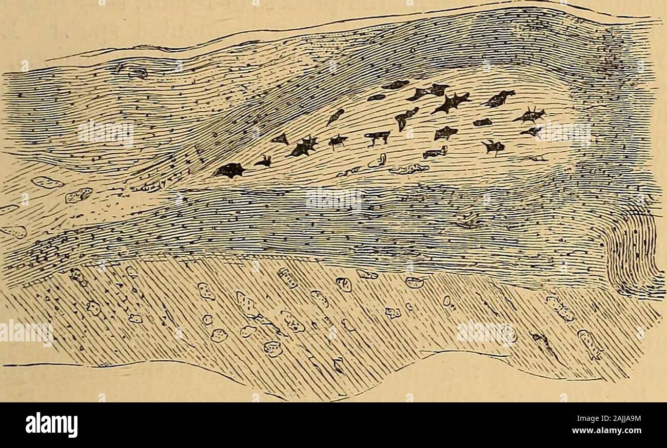 Calcification process hi-res stock photography and images - Alamy