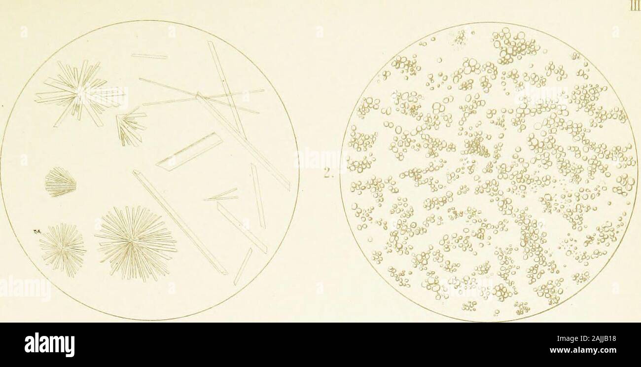 Atlas of urinary sediments; with special reference to their clinical ...