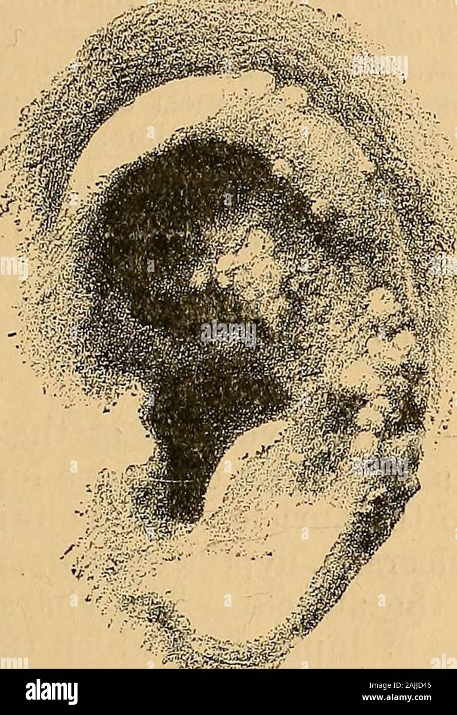 Scrofulous hi-res stock photography and images - Alamy