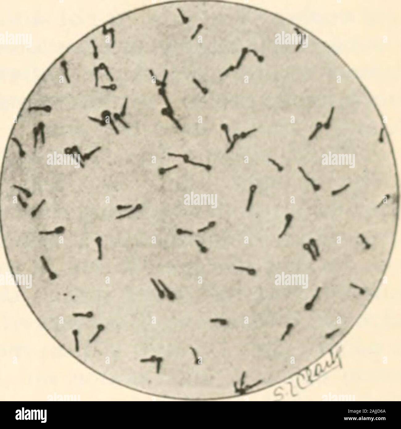 Diphtheria Bacteria Structure