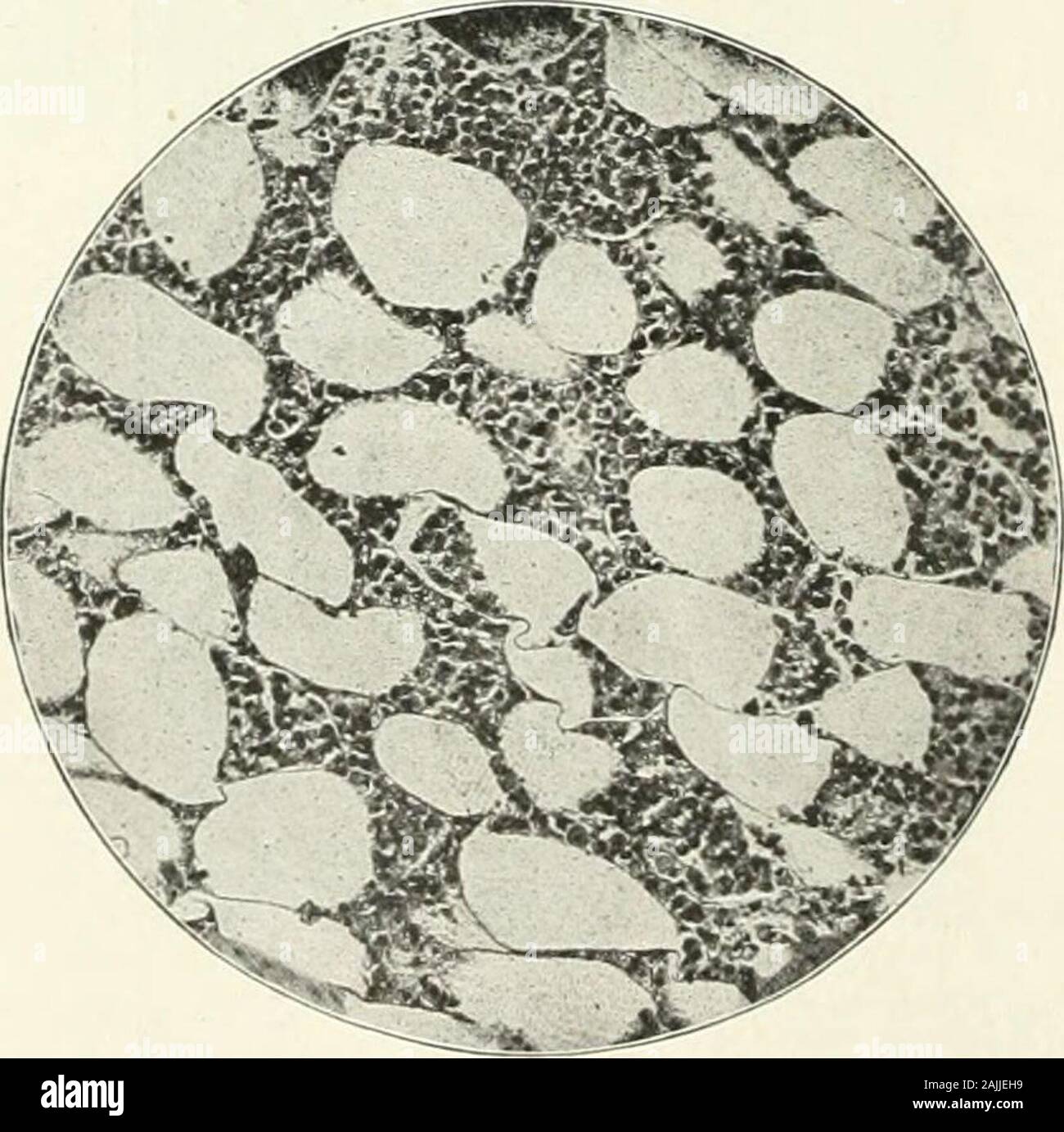 Lymph nodes in connective tissue hi-res stock photography and images ...