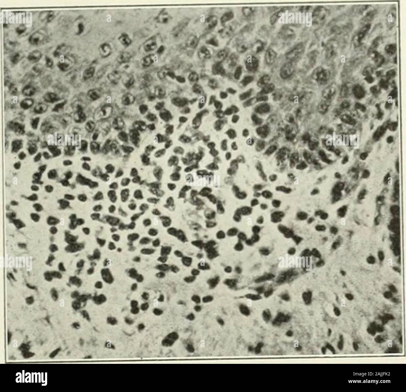 Lymph nodes in connective tissue hi-res stock photography and images ...