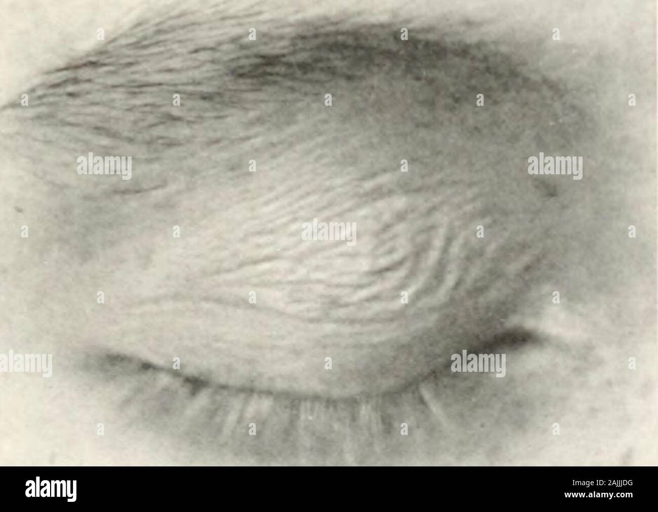 Transactions . Fig. .i.—Case 2. Illustrating the atonic told of Fig. 4 ...