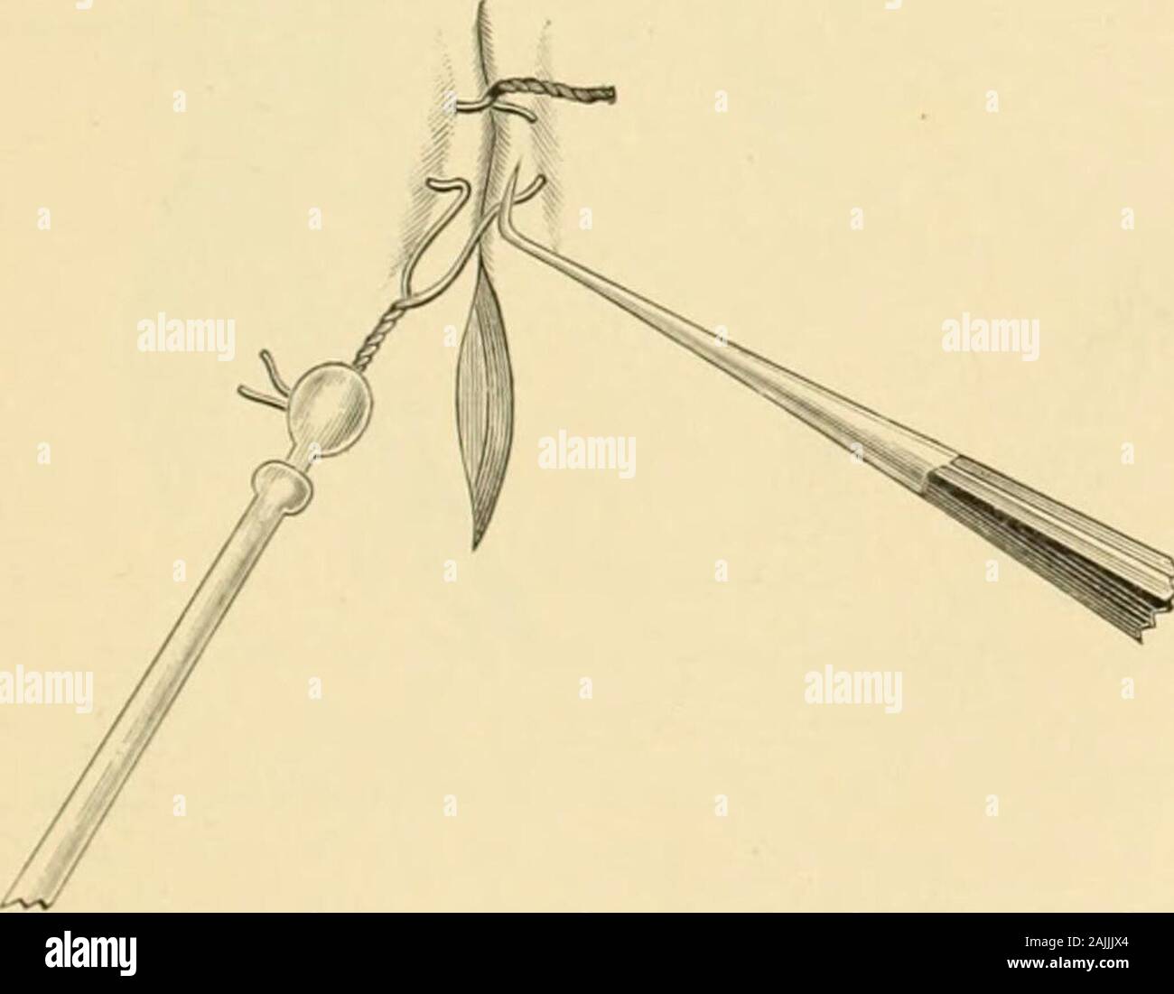 Gynecological surgery hi-res stock photography and images - Alamy