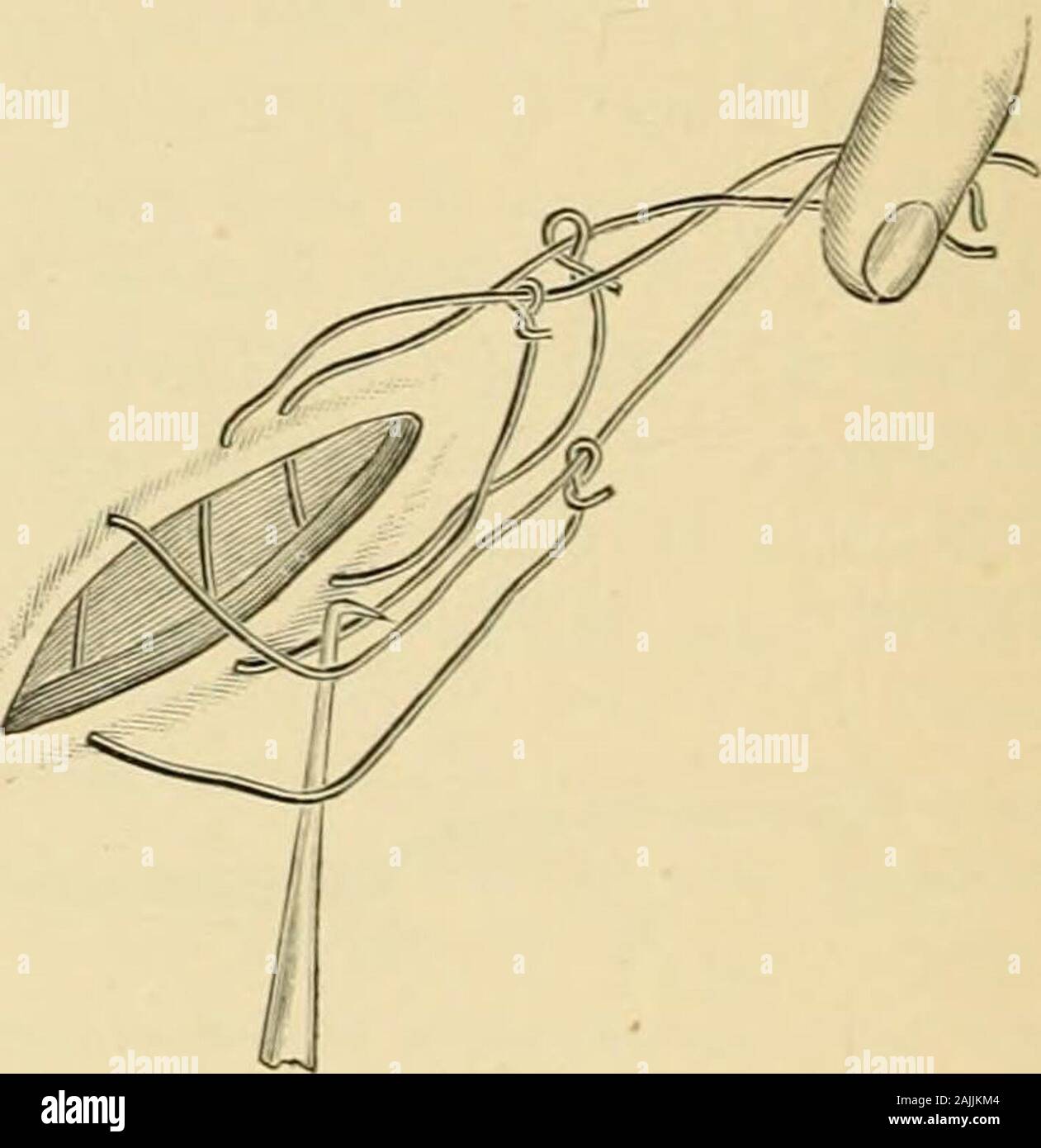 Tenac hi-res stock photography and images - Alamy