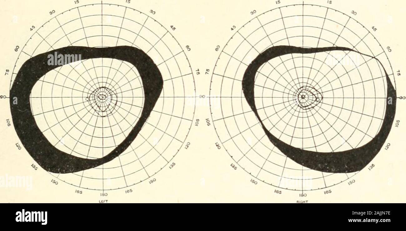 Transactions . palsies.Upon lateral rotation of the eyes, rotary ...