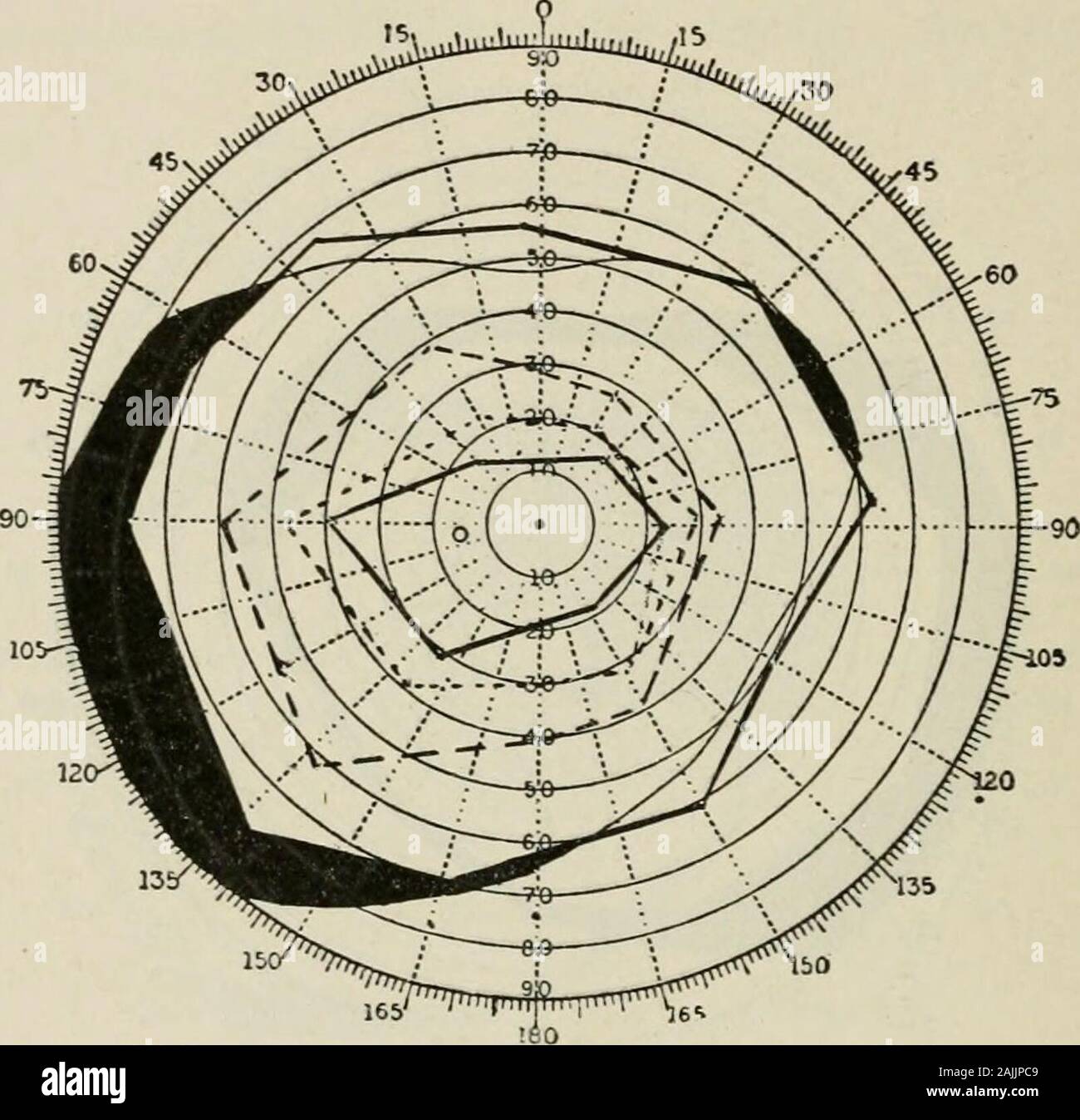 Test detachment hi-res stock photography and images - Alamy