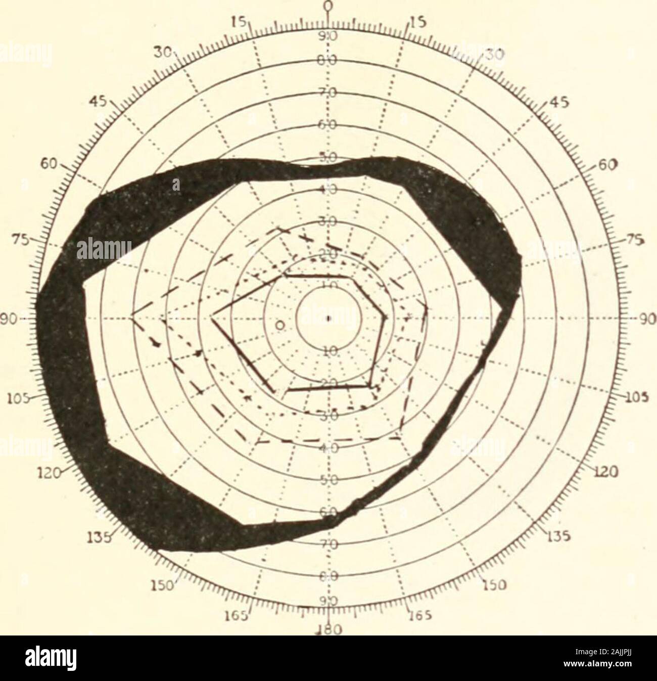 Transactions . Blue Fig. 1.—Visual Field. Before Operation. compression ...