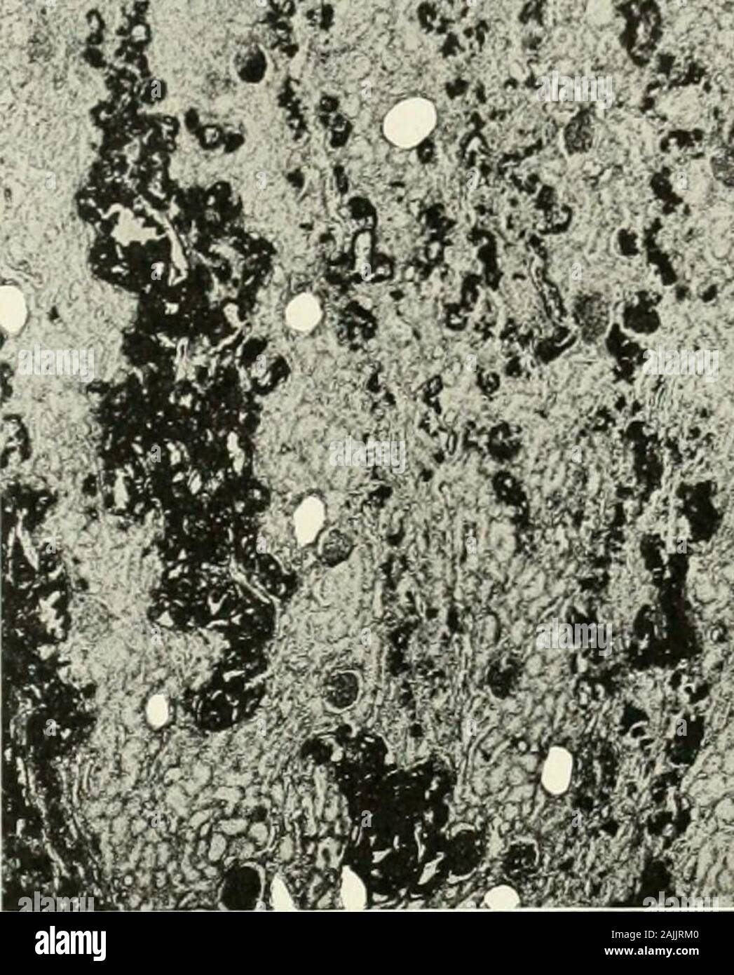 Calcium soaps hi-res stock photography and images - Alamy