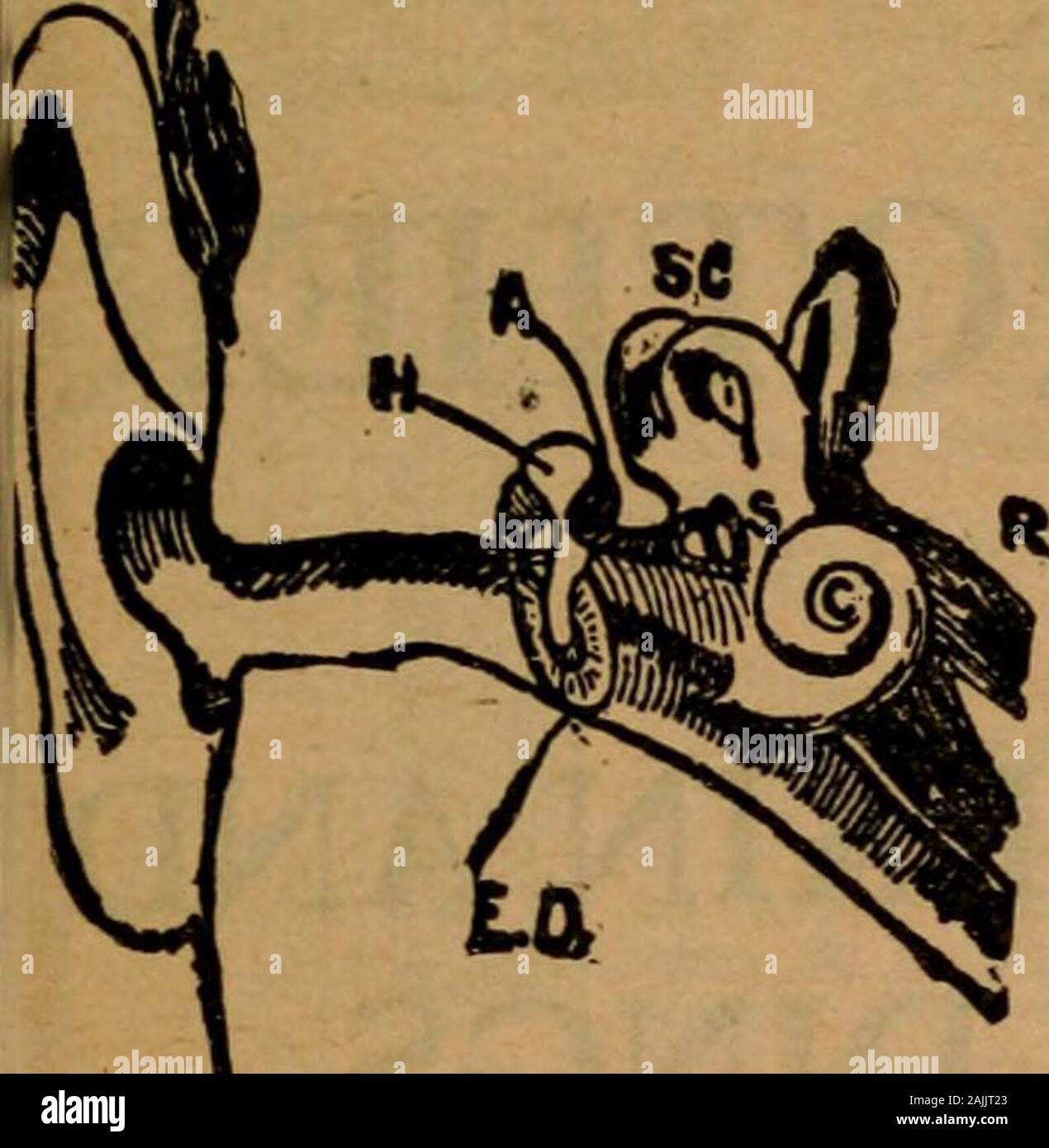 Clogged ear hi-res stock photography and images - Alamy