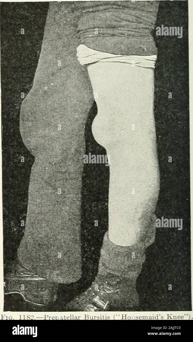 Metatarsal shoes hi-res stock photography and images - Alamy