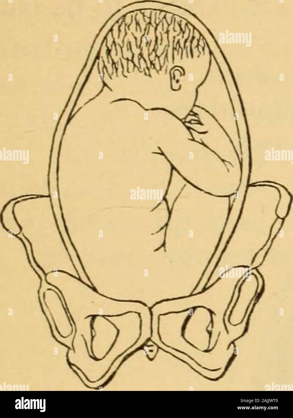 Childs buttocks hi-res stock photography and images - Alamy