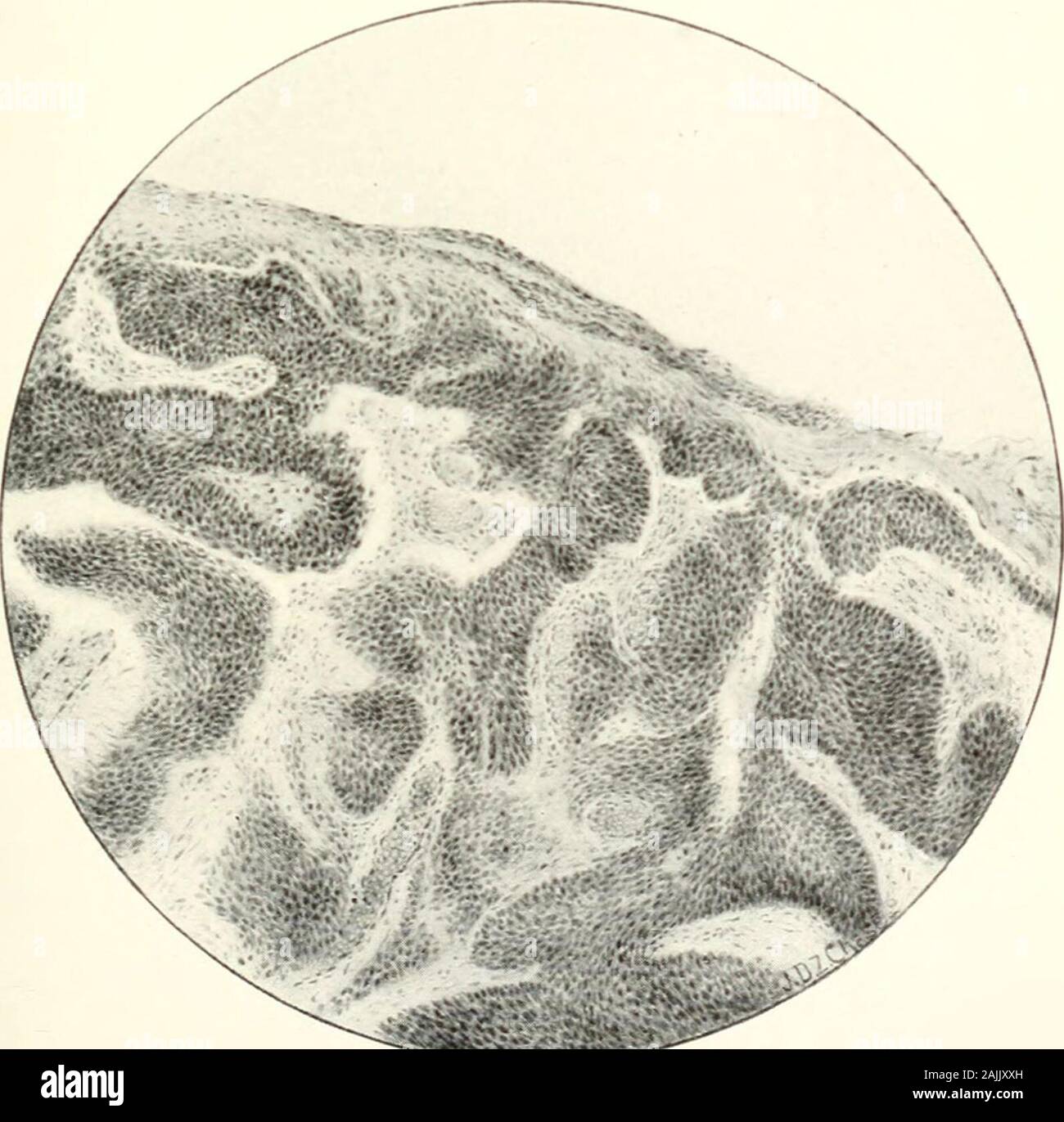 Transactions . Fig. 1.—Section of oy(l)all showing position of epil)uil ...
