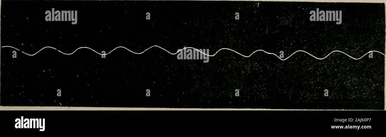 The physical signs of cardiac disease, for the use of clinical students ...
