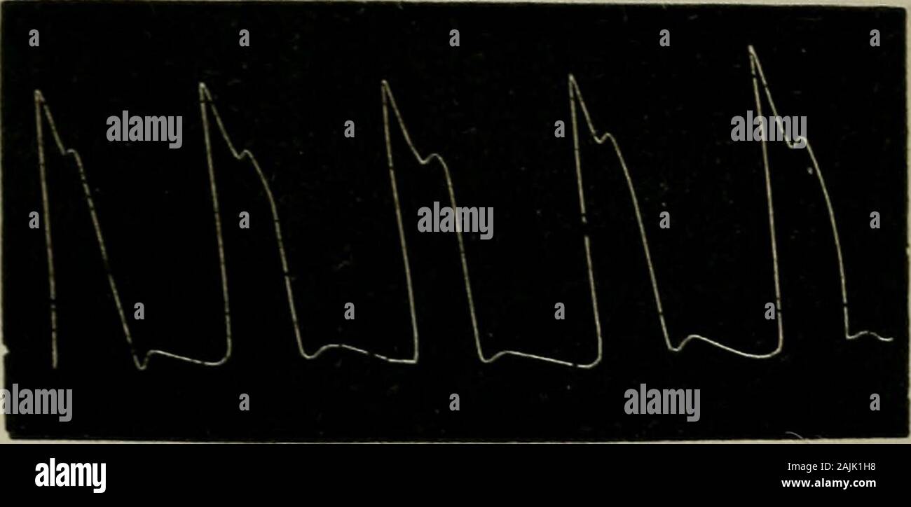 The physical signs of cardiac disease, for the use of clinical students ...