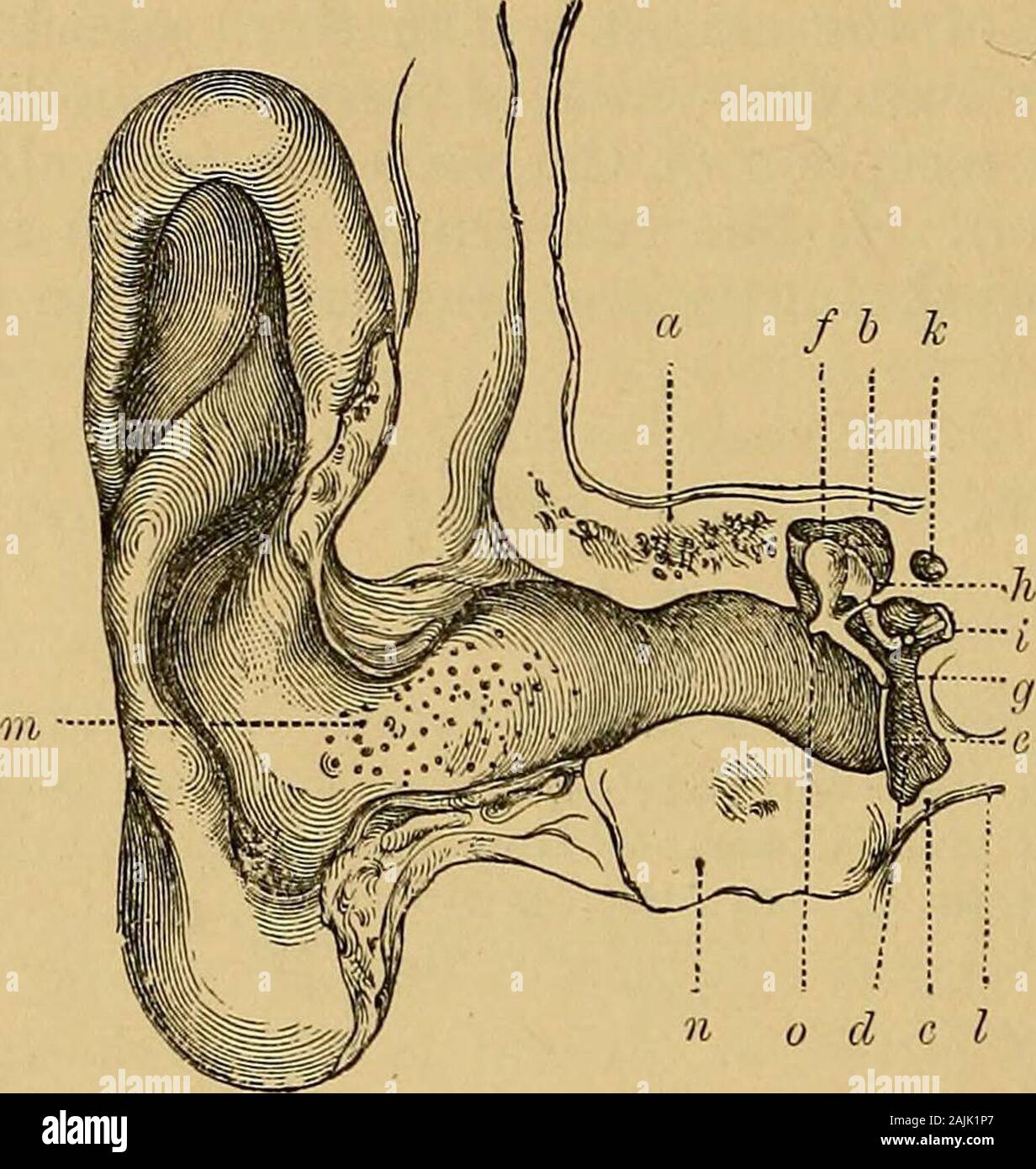 Manubrium Ear