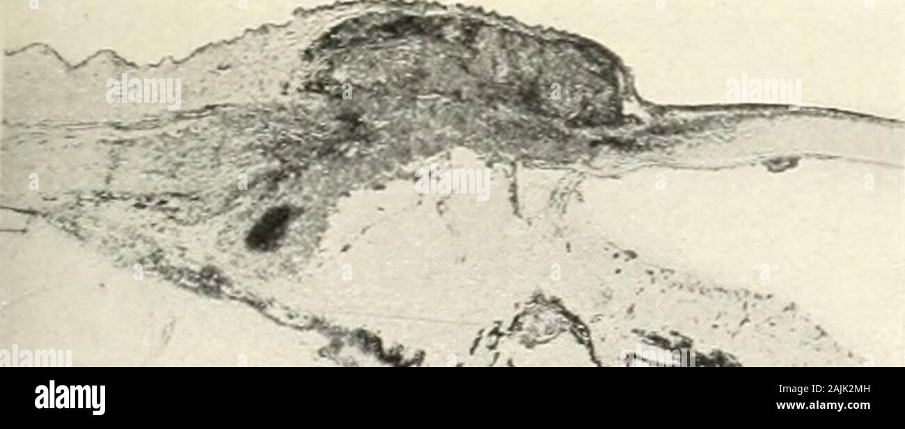 Posterior tubercles hi-res stock photography and images - Alamy