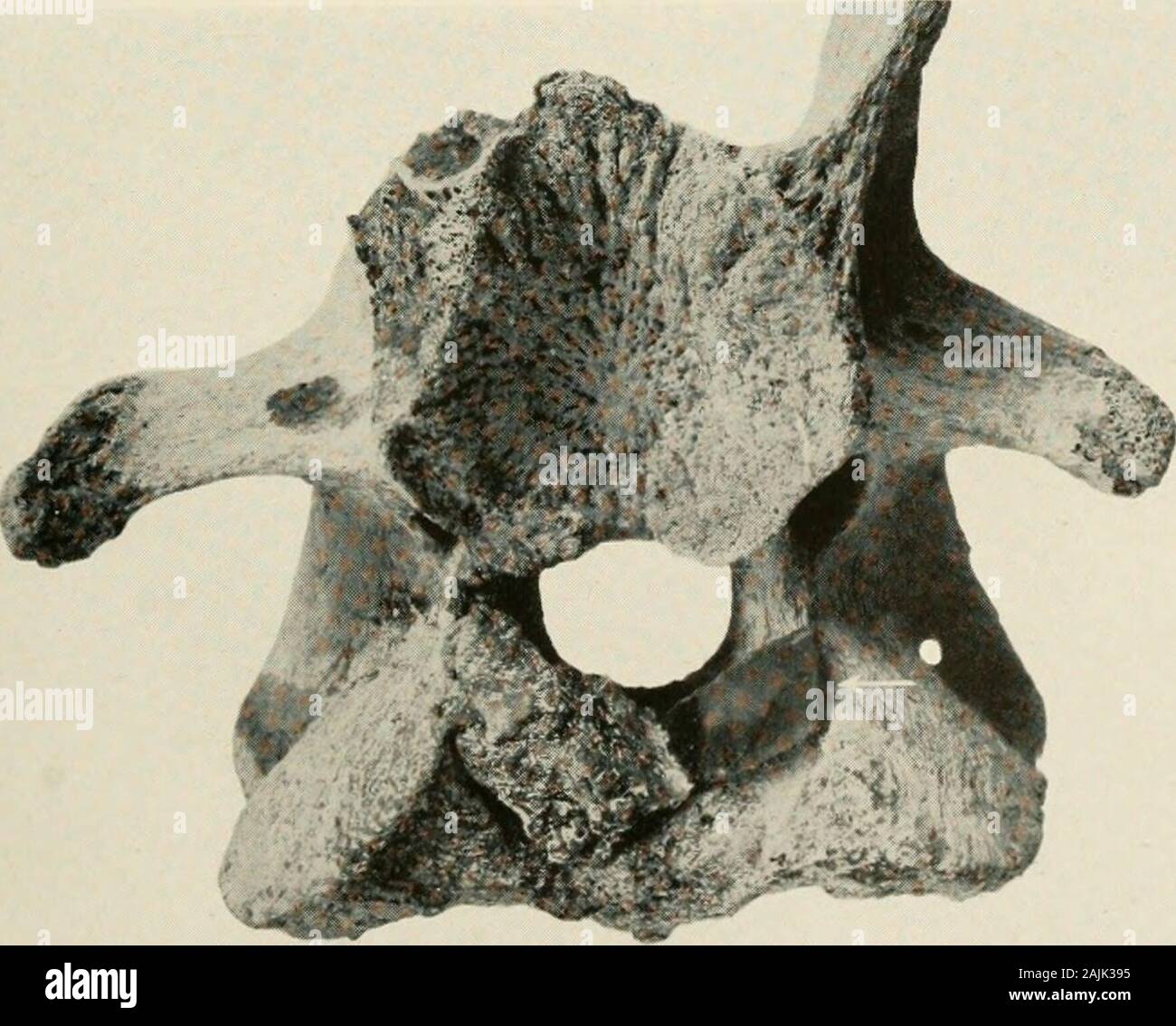 Vertebral foramen hi-res stock photography and images - Alamy