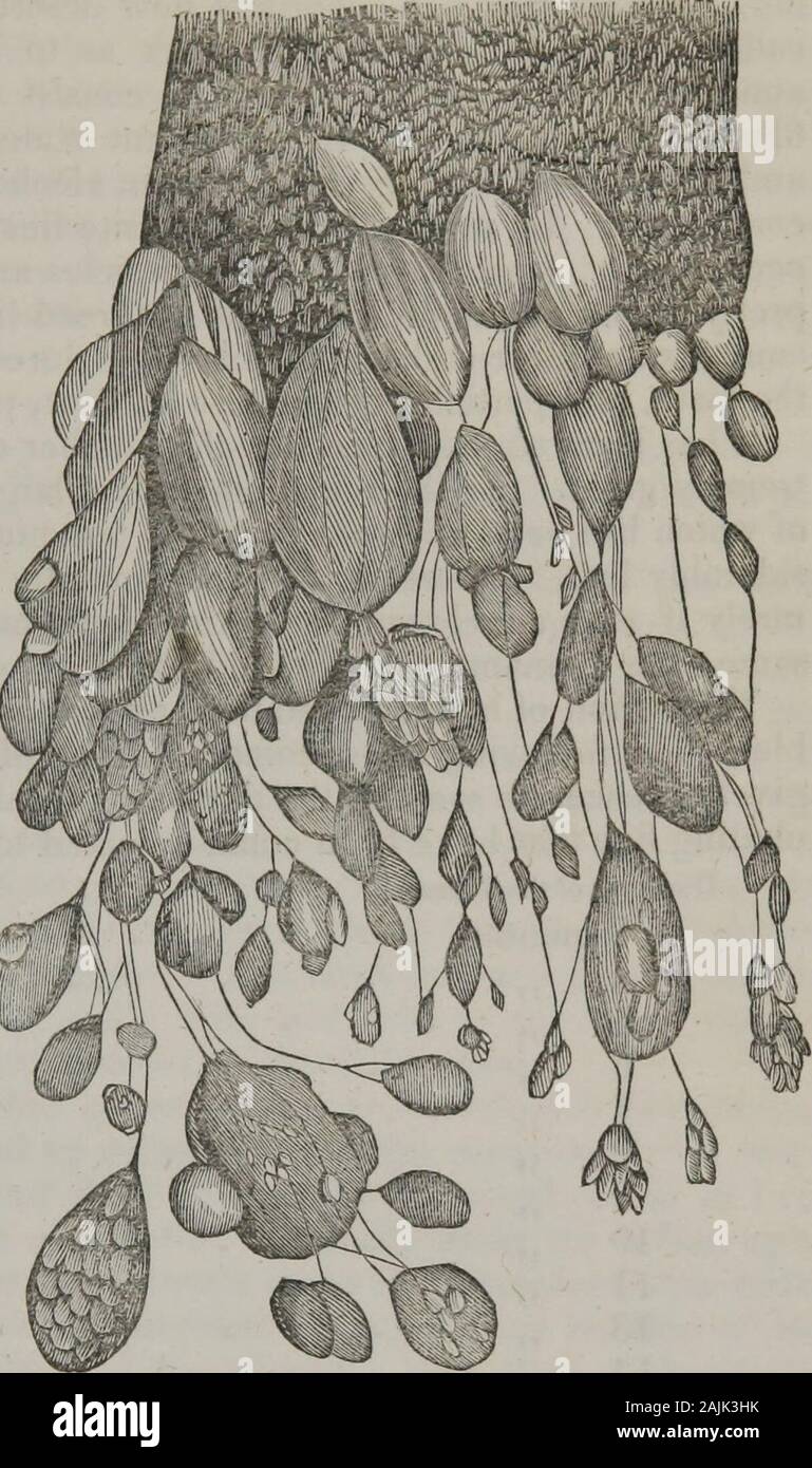 Blighted ovum hi-res stock photography and images - Alamy