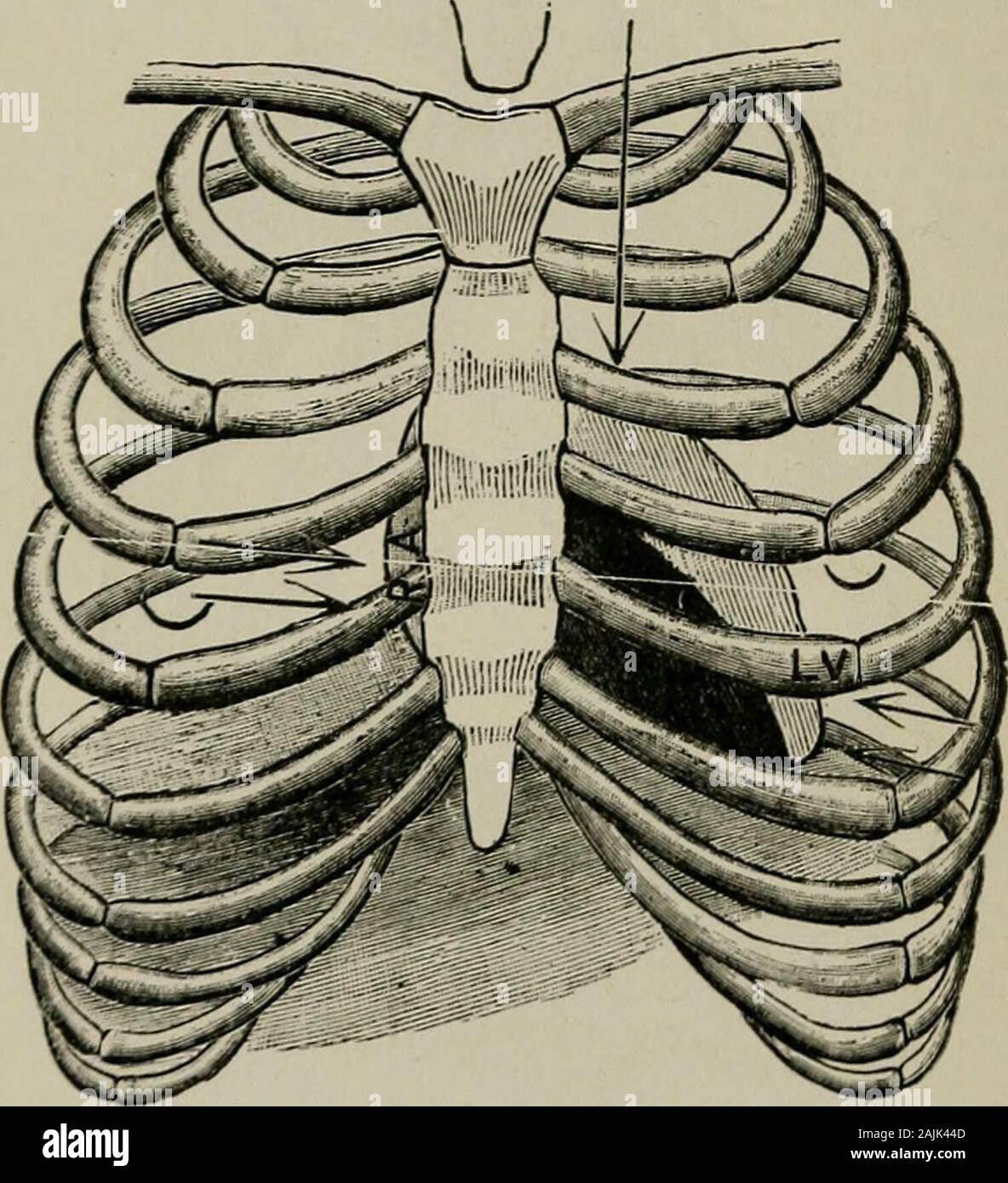 Disease dropsy hi-res stock photography and images - Alamy