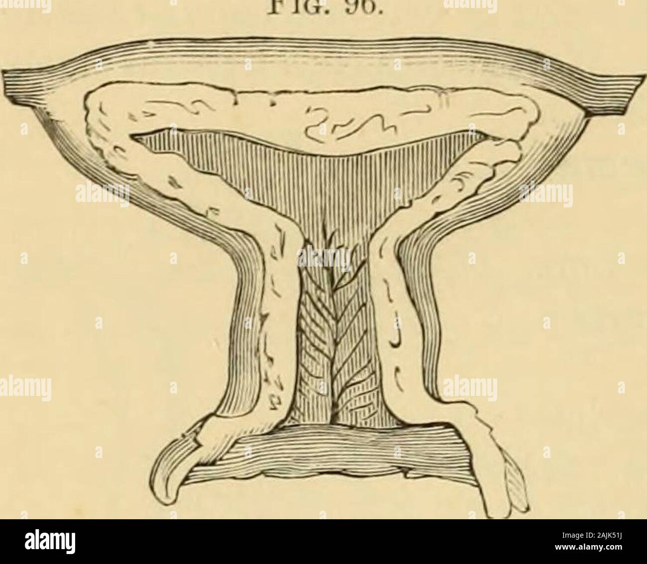 A system of gynecology . ; theneck. 24; the isthmus. 5; ami the body ...