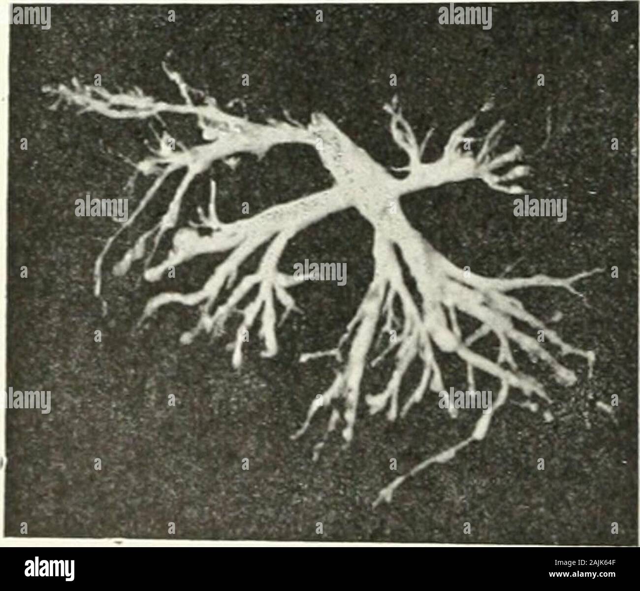 A reference handbook of the medical sciences, embracing the entire ...