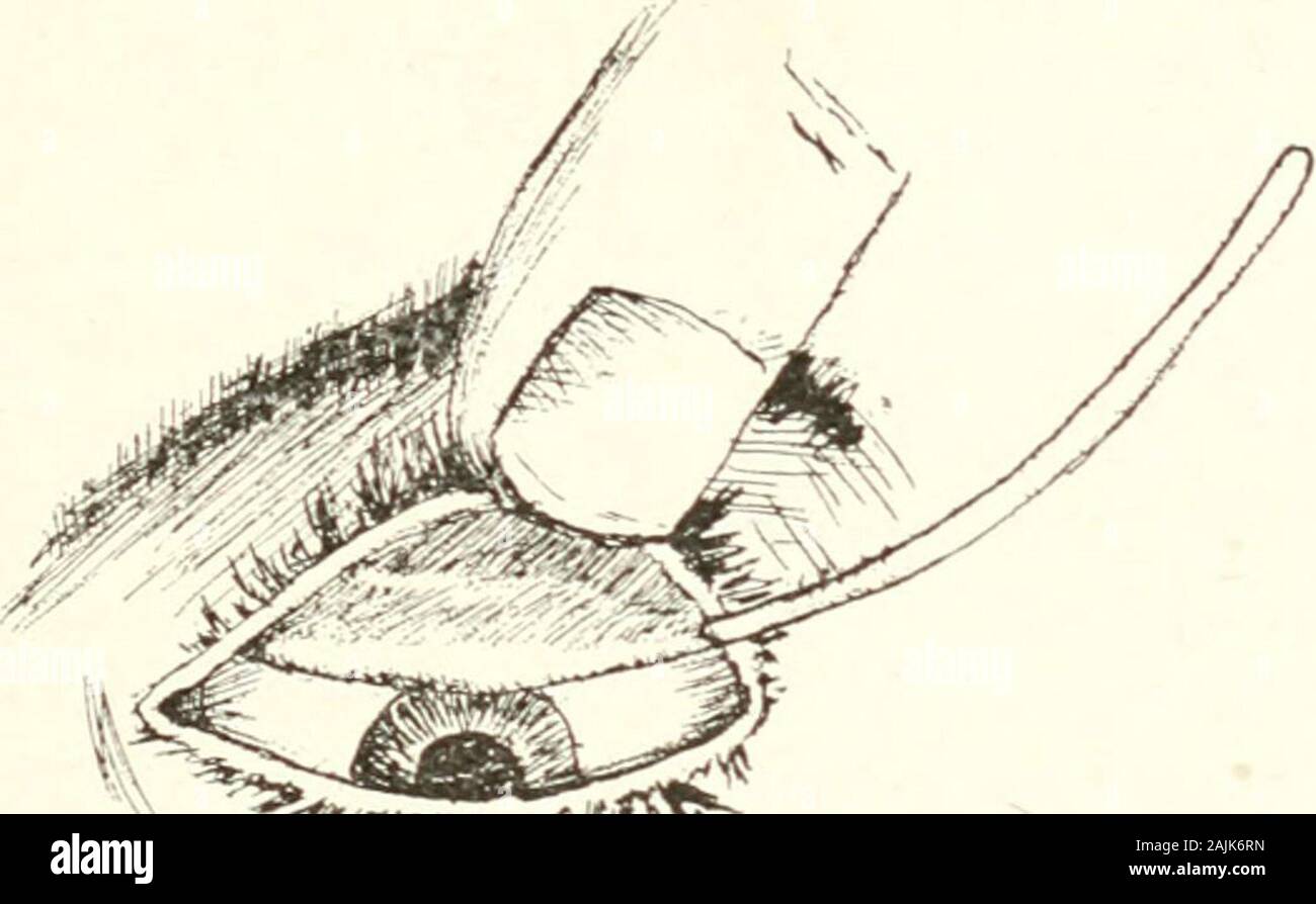 Palpebral conjunctiva hi-res stock photography and images - Alamy