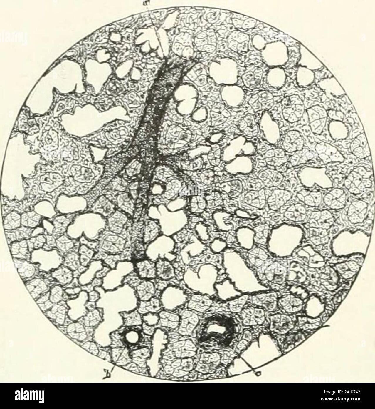Bronchi bronchial tubes hi-res stock photography and images - Alamy