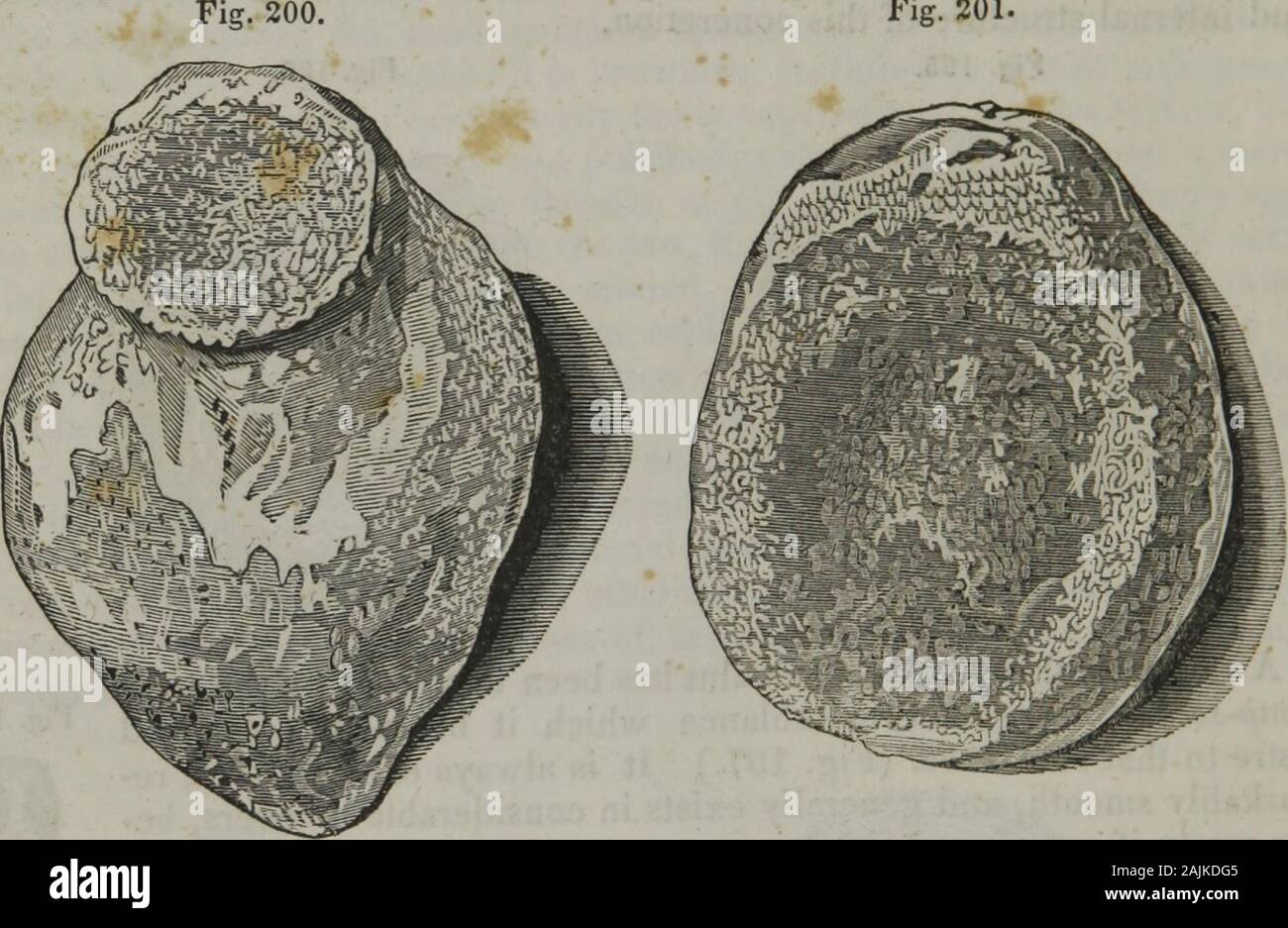 Bladder pipe hi-res stock photography and images - Alamy