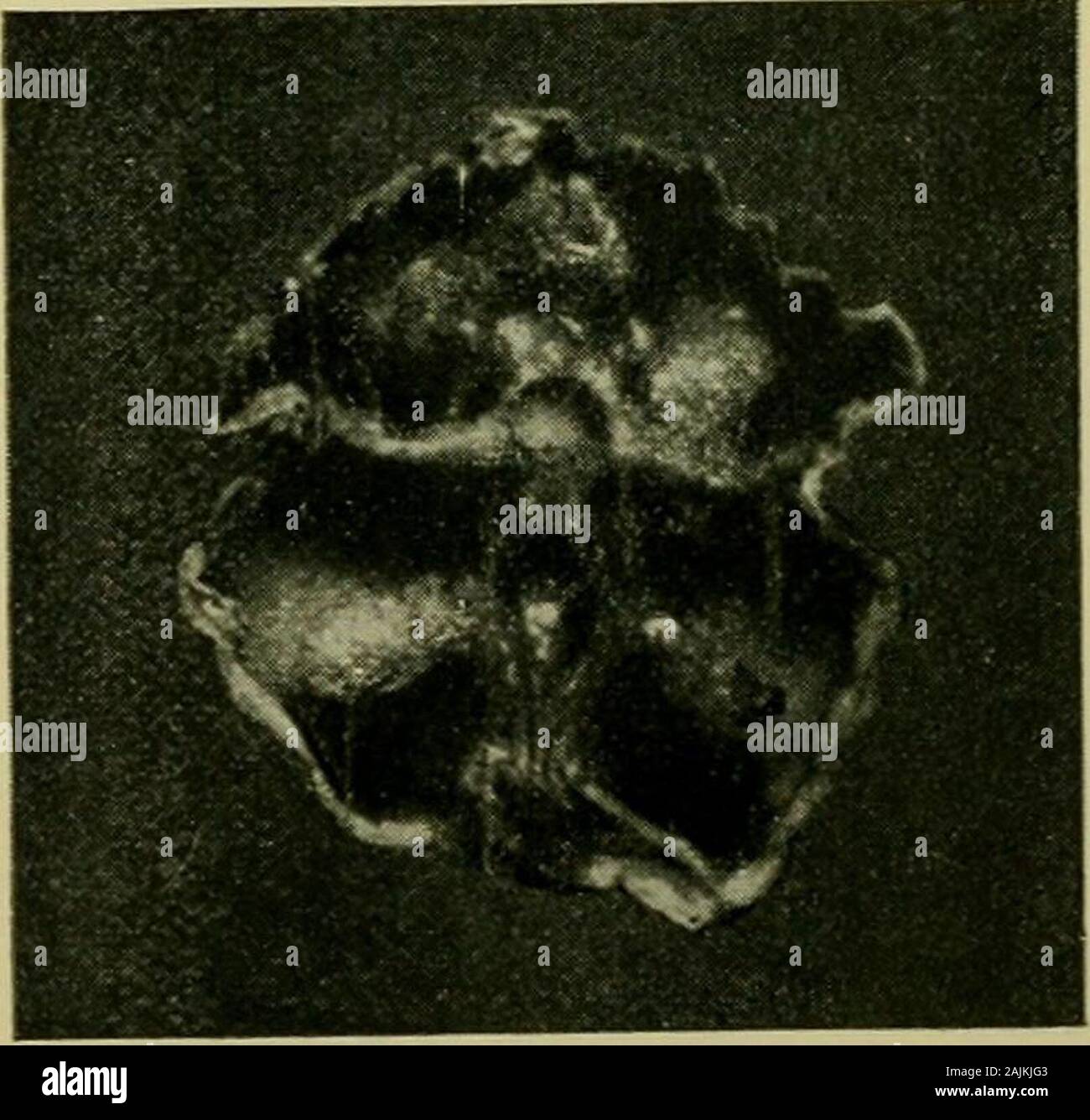 Vertebrae cross section hi-res stock photography and images - Alamy