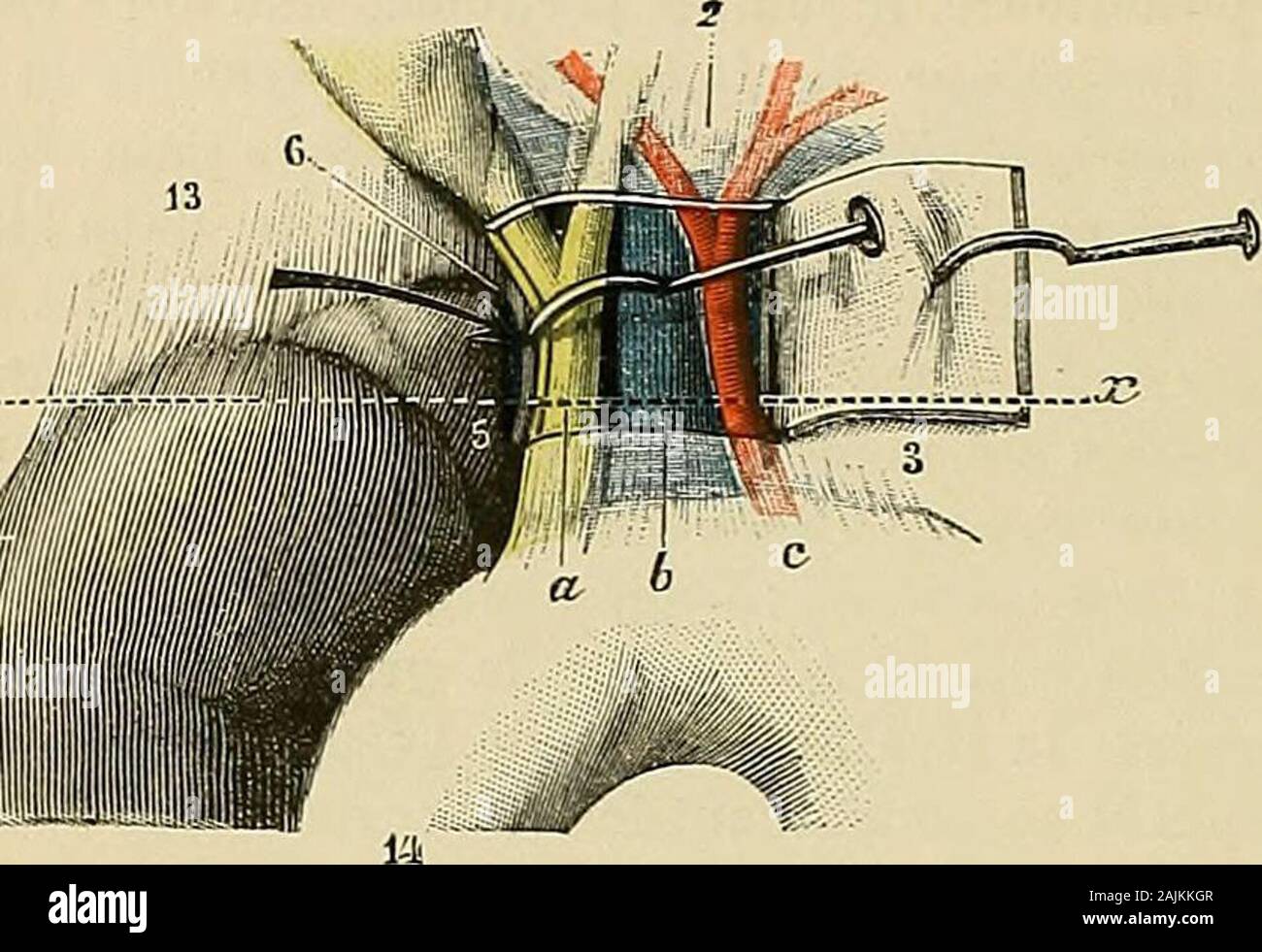 Colique hi-res stock photography and images - Alamy