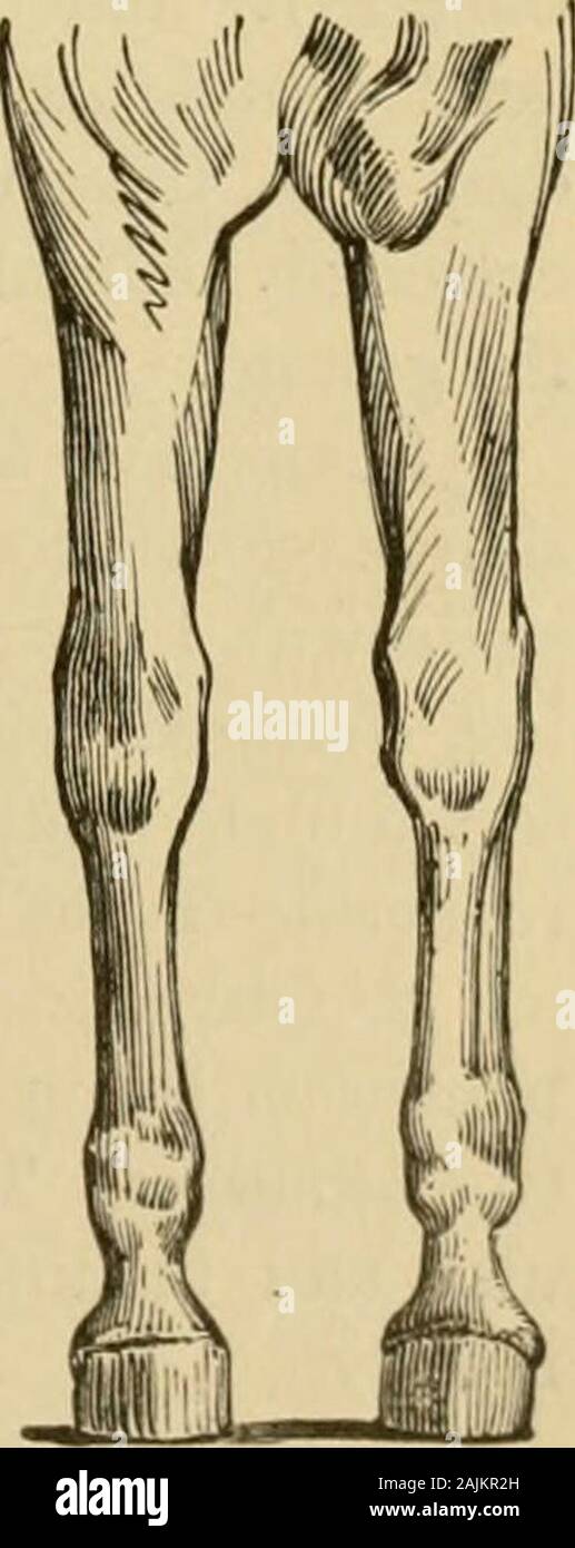 Outward deviation hi-res stock photography and images - Alamy