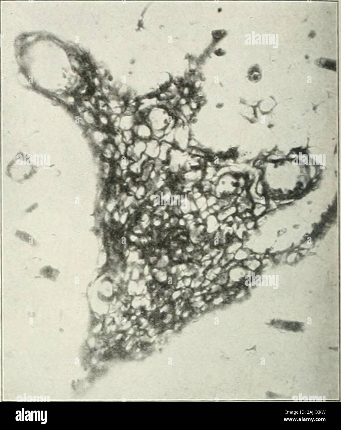 Salvarsan hi-res stock photography and images - Alamy