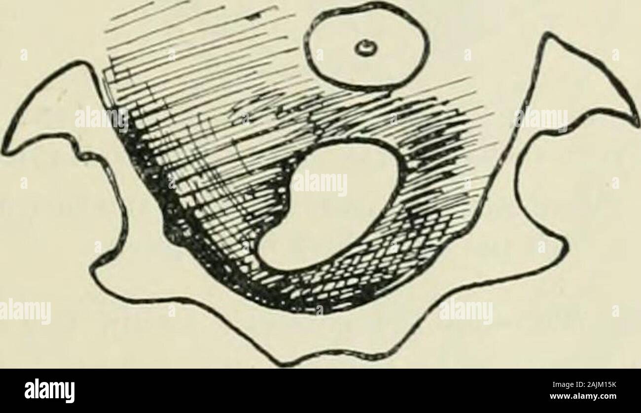 Cellulitis child hi-res stock photography and images - Alamy