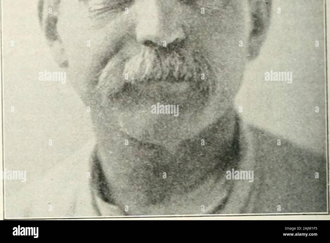 Palsies hi-res stock photography and images - Alamy