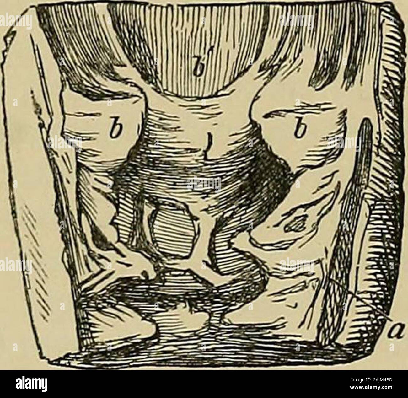 Conus Arteriosus Infundibulum