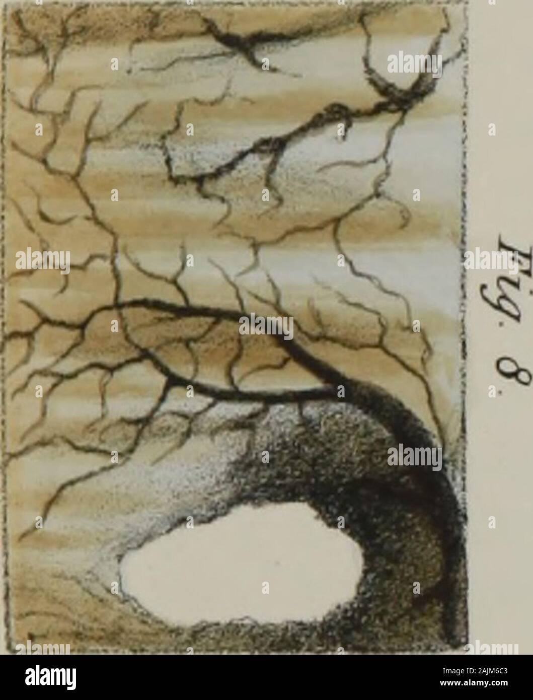 Elements of pathological anatomy Stock Photo - Alamy