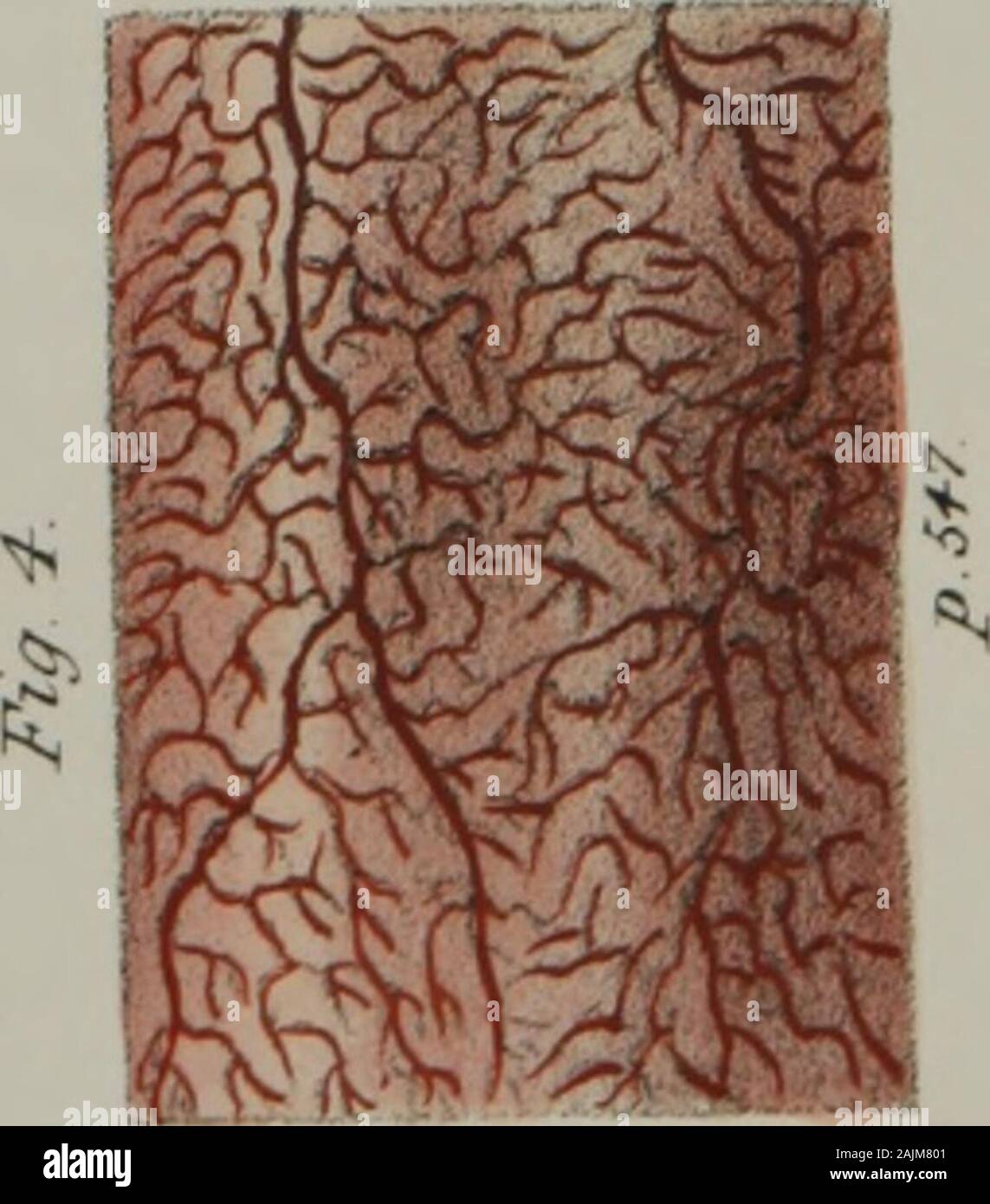 Elements of pathological anatomy Stock Photo - Alamy