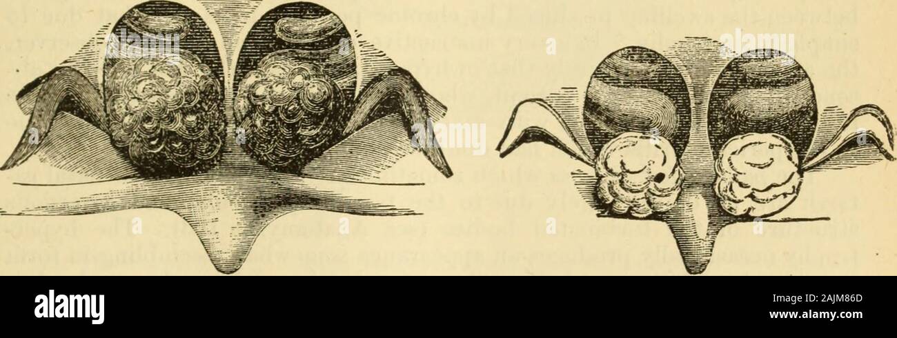 A manual of diseases of the throat and nose : including the pharynx ...