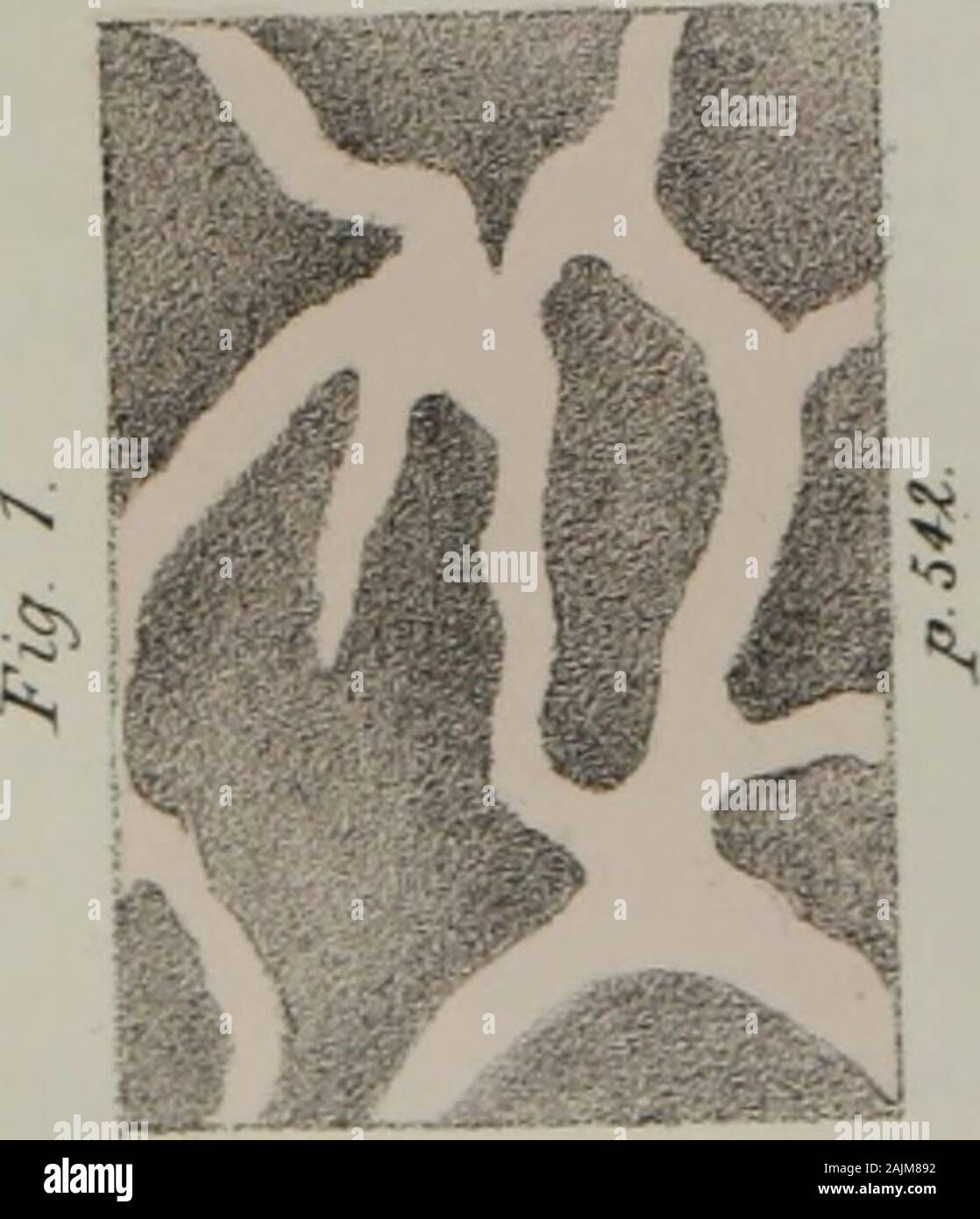 Elements of pathological anatomy Stock Photo - Alamy