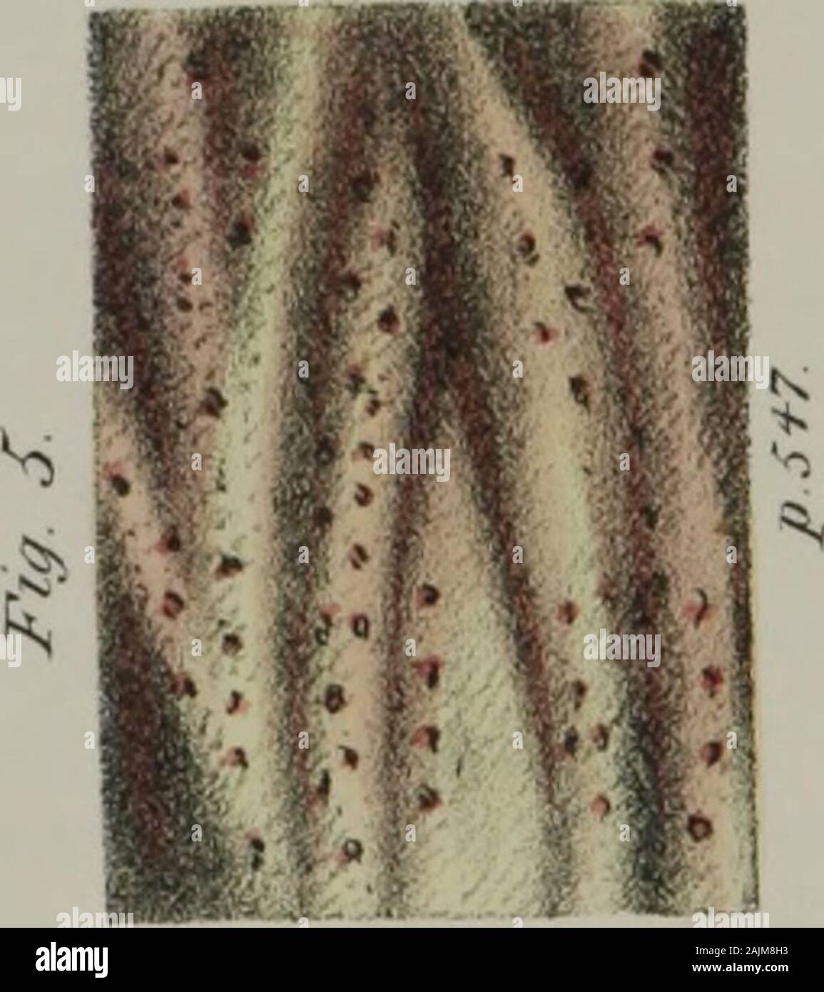 Elements of pathological anatomy Stock Photo - Alamy