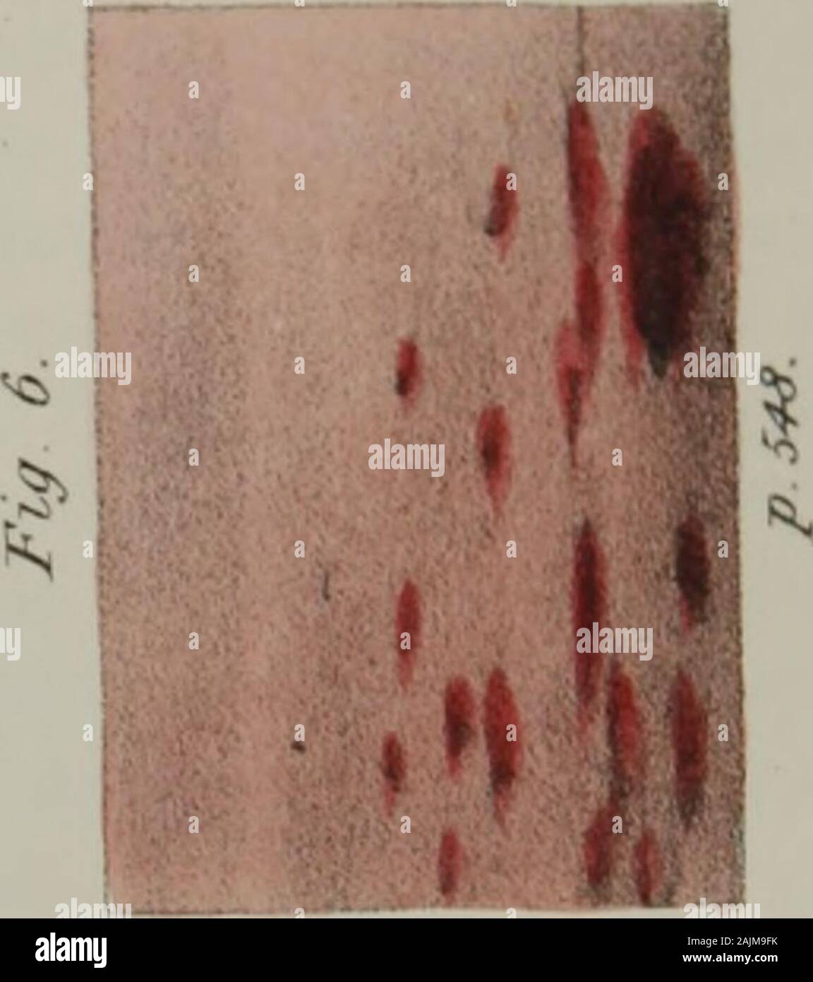 Elements of pathological anatomy Stock Photo - Alamy