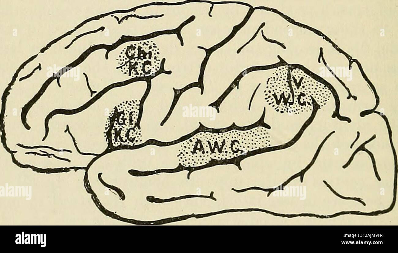 Wernicke brain hi-res stock photography and images - Alamy