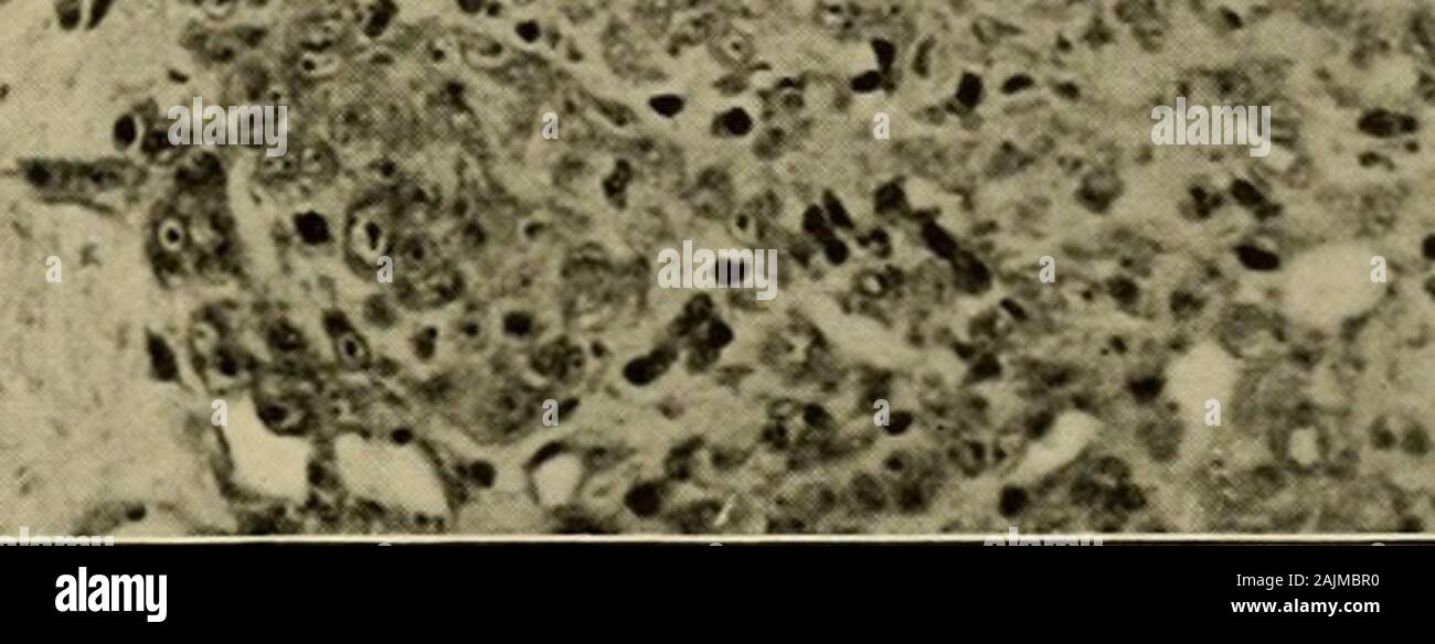 Oedematous hi-res stock photography and images - Alamy