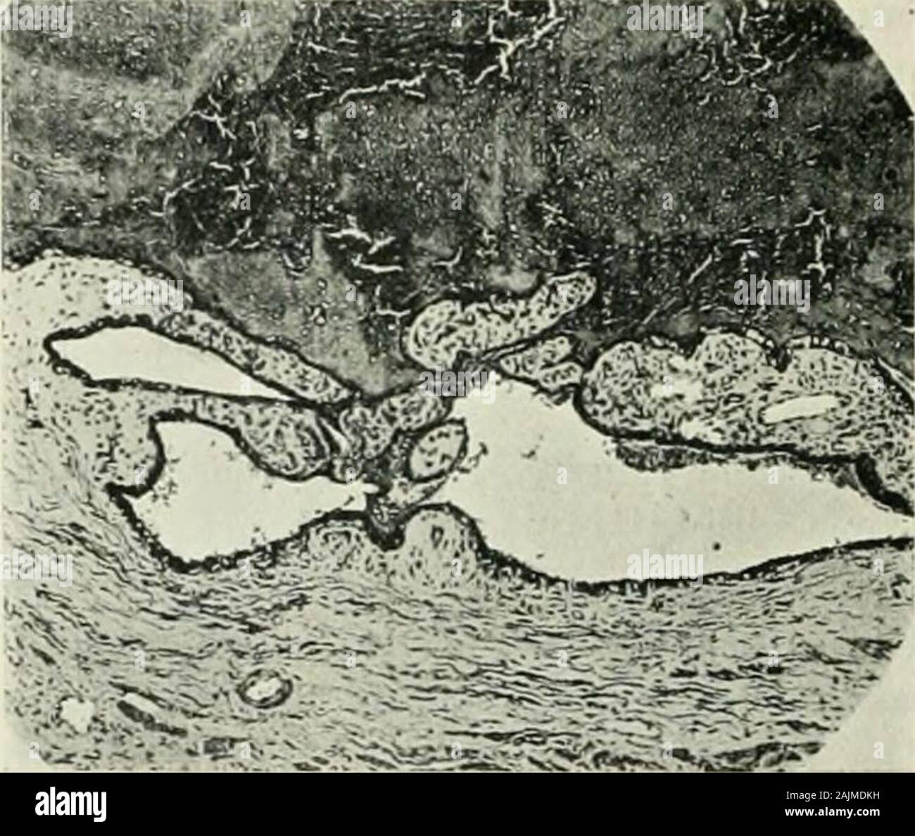 Gynecological diagnosis and pathology . ows a tubalpregnancy which has ...