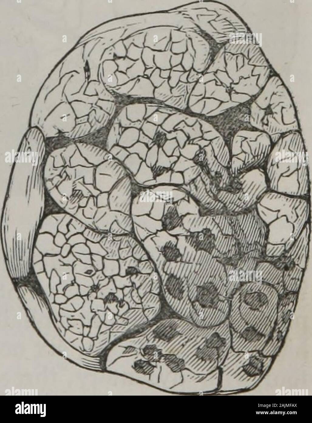 Distorted anatomy hi-res stock photography and images - Alamy