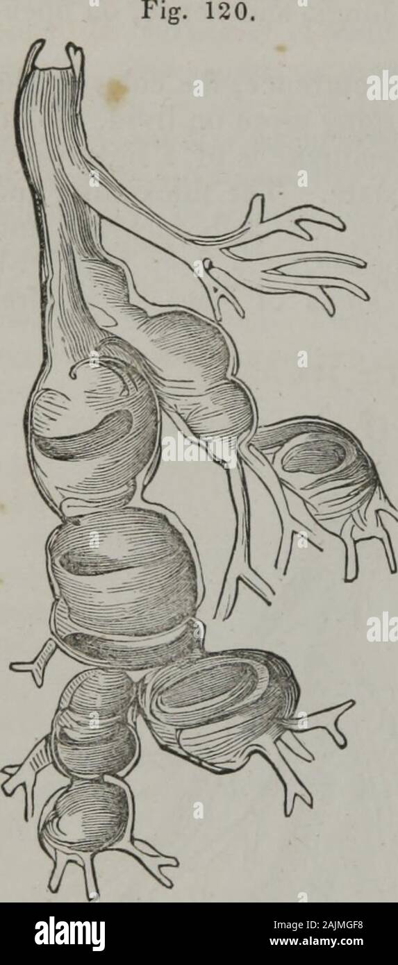 Elements of pathological anatomy . derable, and embracea large number ...