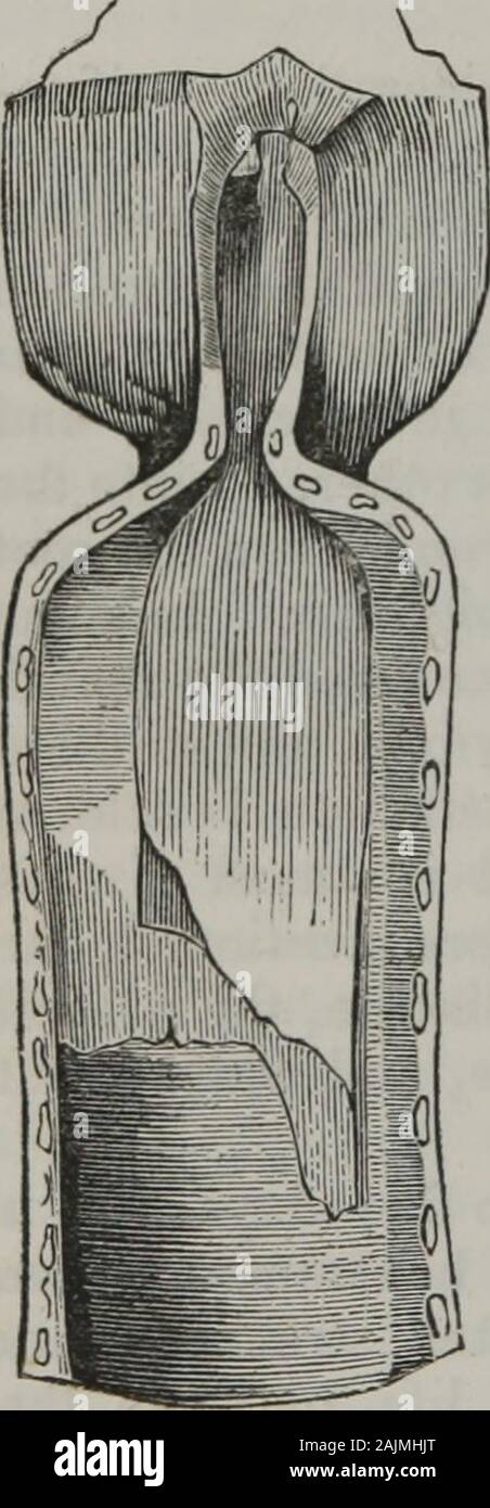 Elements of pathological anatomy . on-jecture, which requires further ...