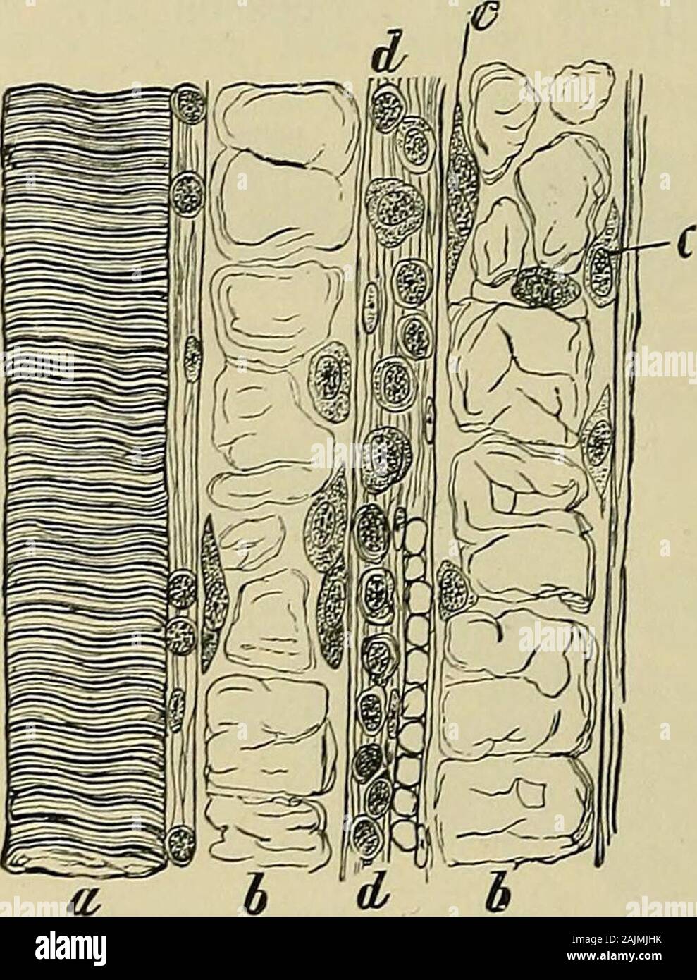 Hard tissue necrosis hi-res stock photography and images - Alamy