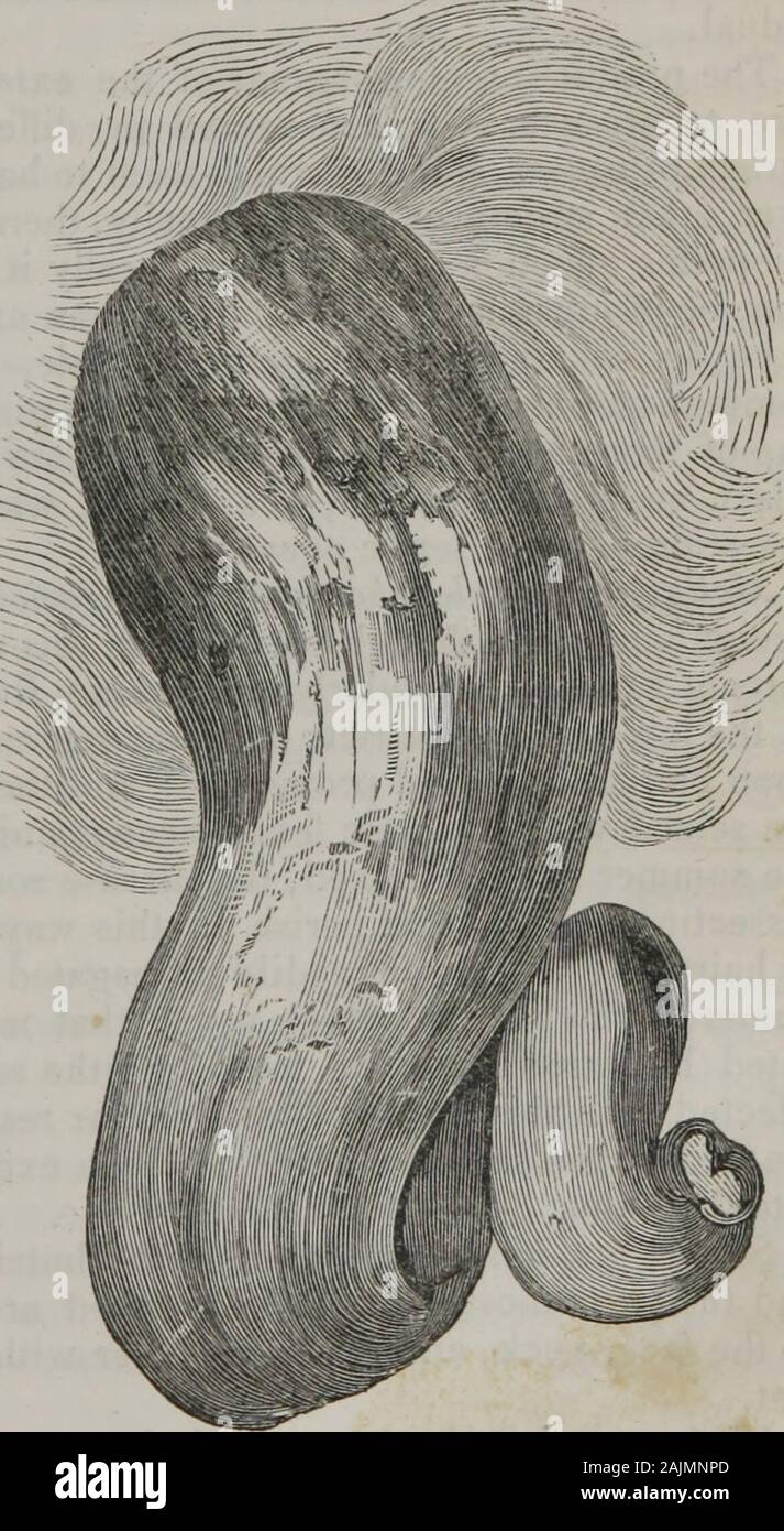 Scrotum anatomy hi-res stock photography and images - Alamy